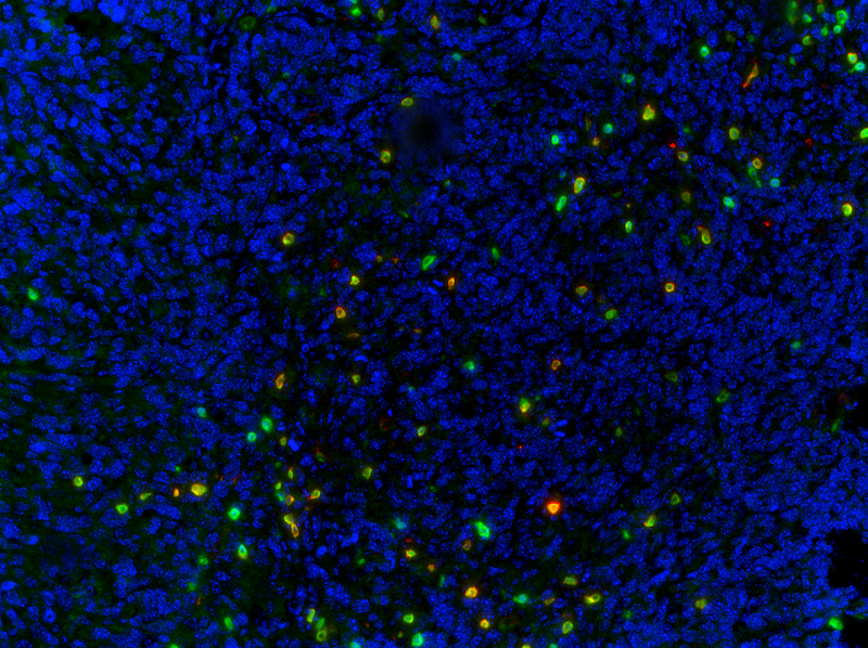 Demystifying Antibody Panel Design for Multiplex IHC Demystifying Antibody Panel Design for Multiplex IHC